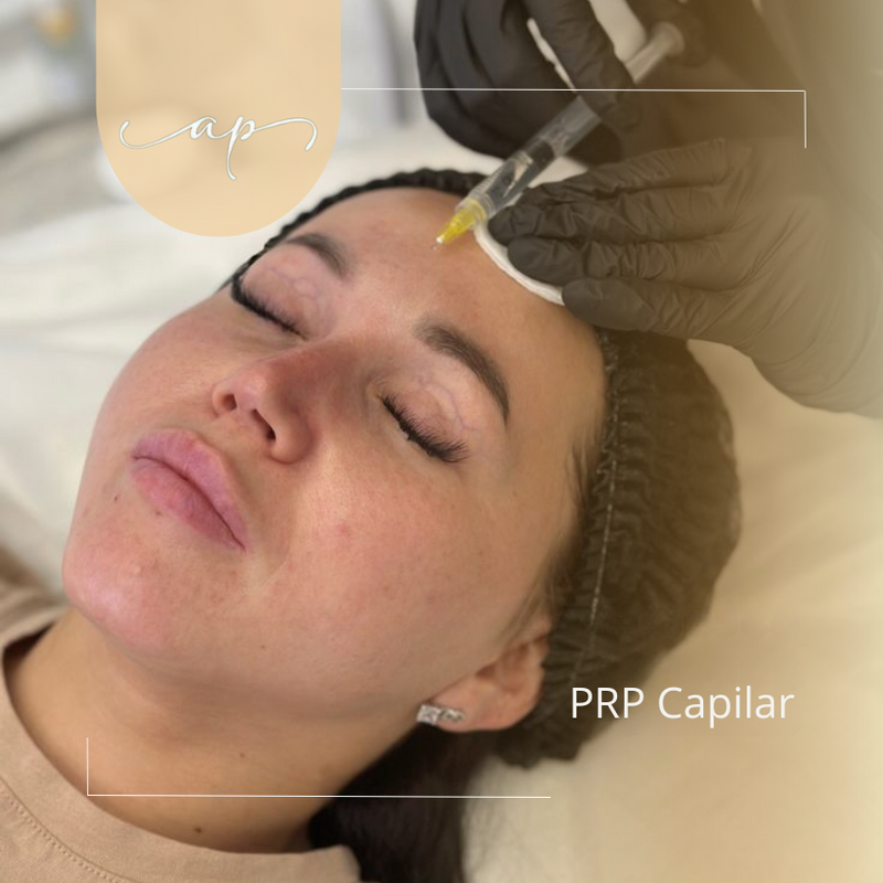 Plasma rico en plaquetas (PRP)